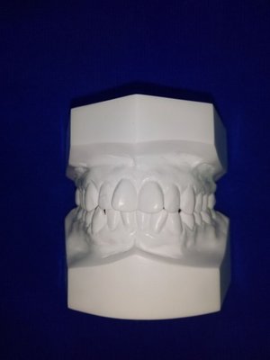 Smooth Surface Orthodontic Appliances 3D Printing Models For Dental Laboratory