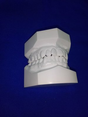 Smooth Surface Orthodontic Appliances 3D Printing Models For Dental Laboratory