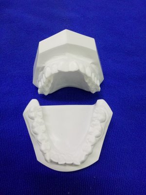 Smooth Surface Orthodontic Appliances 3D Printing Models For Dental Laboratory