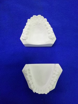Smooth Surface Orthodontic Appliances 3D Printing Models For Dental Laboratory