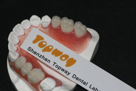 Lightweight Dental Valplast Flexible Dentures , Removable Valplast Partial Denture