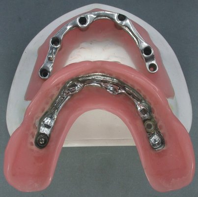 Metal Based Implant Bar Attachment For Dentures , Locator Overdenture Attachments