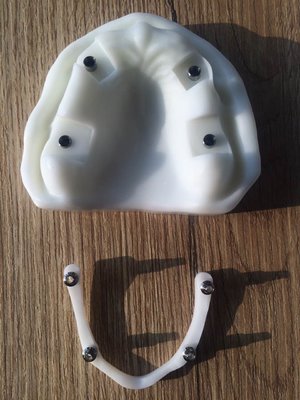 High Retention Implant Support Dentures , Titanium Hybrid Implant Bar Attachment