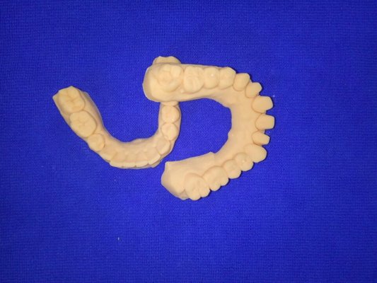 Dental Laboratory 3D Printed Models Smooth Surface , 3D Printing In Orthodontics