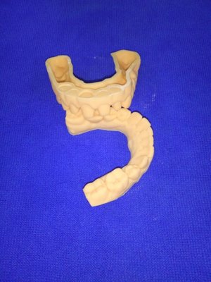 Dental Laboratory 3D Printed Models Smooth Surface , 3D Printing In Orthodontics