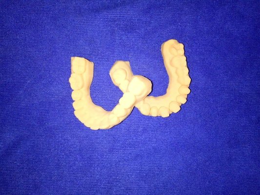 Dental Laboratory 3D Printed Models Smooth Surface , 3D Printing In Orthodontics