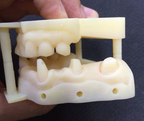 Dental Labs Digital 3D Printed Dental Implants Model Highly Precision