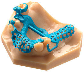 3D Printing Dental Framework Models For Dentistry And Orthodontics Resistant To Shock