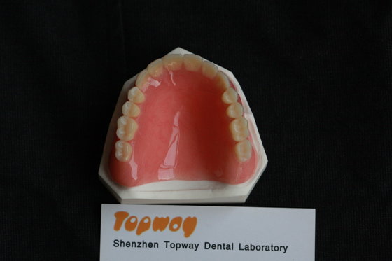 Removable Smooth Acrylic Full Upper Arch Denture For Replace Missing Teeth