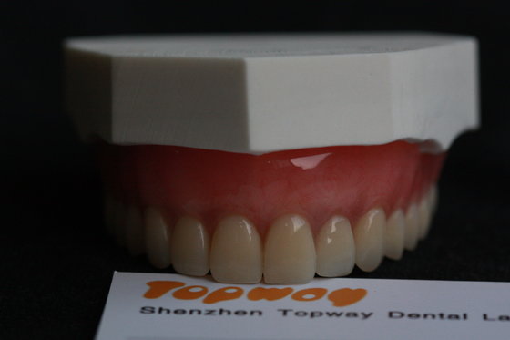 Removable Smooth Acrylic Full Upper Arch Denture For Replace Missing Teeth