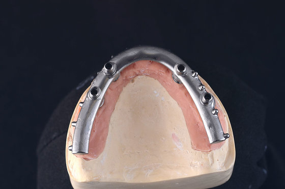 Precision Hybrid Implant Bar Attachments , Locator Attachments For Dentures