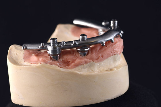 High Retention Titanium Implant Bar Attachment Full Mouth For Dental Laboratory