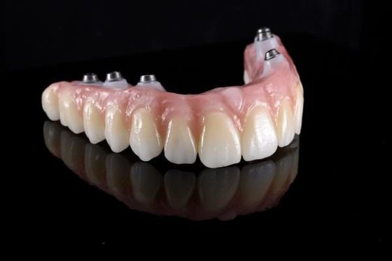 Titanium Hader Bar Attachments , Implant Bar Attachments for Detachable Dentures