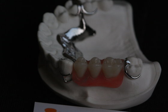 Dental Laboratory Flexible Acrylic Partial Denture Metal Free Easy To Change