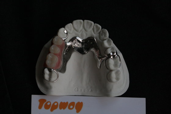 Dental Laboratory Flexible Acrylic Partial Denture Metal Free Easy To Change