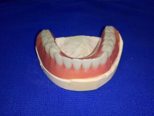 Full Lower Arch Acrylic Denture Teeth  With Densply Base Polymers Material