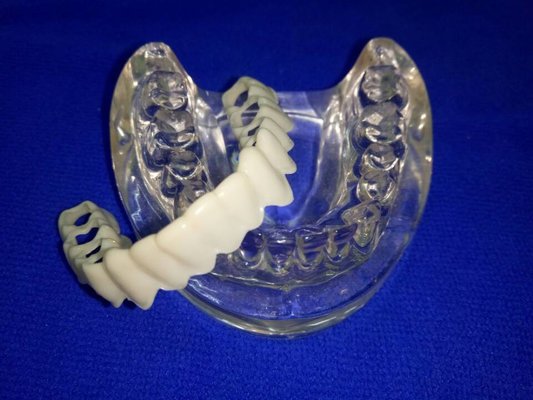 Comforatable Snap on Snap With Germany Dentaurum Resin Material