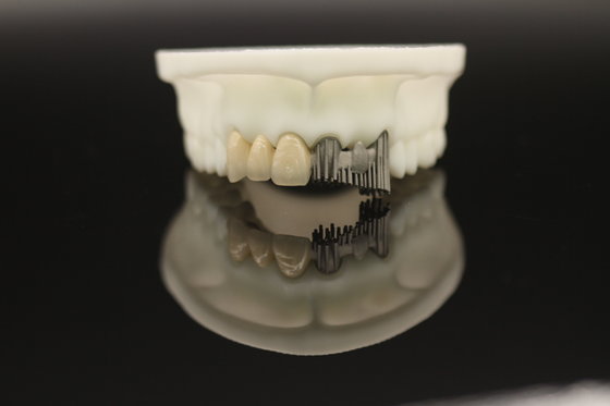 Dental Laser Milled Co-Cr Metal Crowns And Bridge With 3D Printing Technology