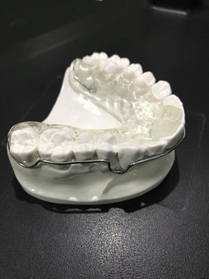 Traditional Lingual Arch Orthodontic Dental Retainer Removable To Straighten Teeth