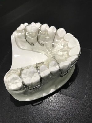 Straightening Teeth Functional Orthodontic Appliances Geheel Open Activator FDA Approved