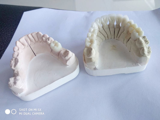 1M1 Shade Full Contoured Zirconia Crown & Bridge With FDA ISO Certificate