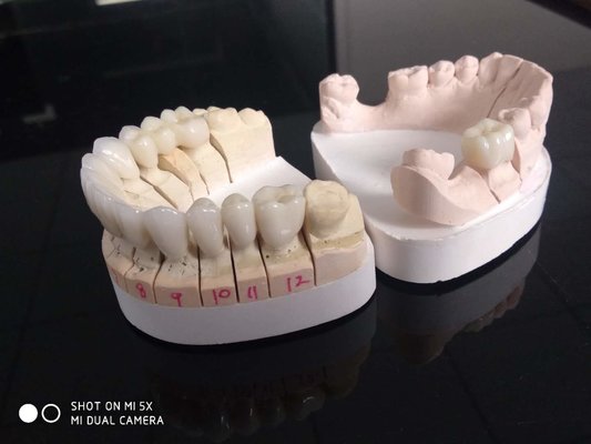1M1 Vita Shade Full Zirconia Dental Crown Lab Fabricating Dentures To Worldwide Clinics