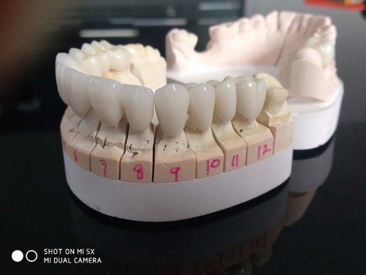 1M1 Vita Shade Full Zirconia Dental Crown Lab Fabricating Dentures To Worldwide Clinics