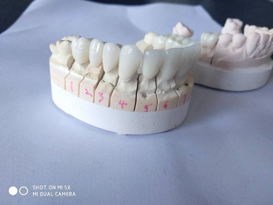 1M1 Vita Shade Full Zirconia Dental Crown Lab Fabricating Dentures To Worldwide Clinics