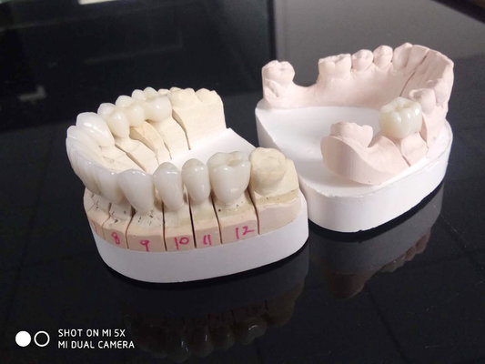 Crown & Bridge Fabricating Dentures With PFZ Technique Offfering Full English Service