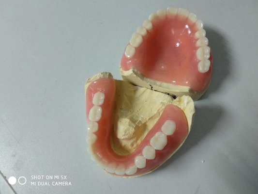 Dental Restoraton Acrylic Removable Partial Denture With Composite Teeth , Easy To Clean