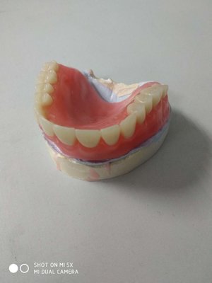 Diagnostic Dental Crown Lab , Accurate Diagnostic Wax Up Model To Produce Precise Fitting Dental Restoration