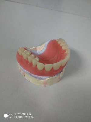 Diagnostic Dental Crown Lab , Accurate Diagnostic Wax Up Model To Produce Precise Fitting Dental Restoration