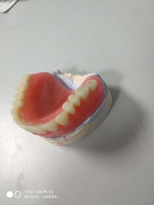 Diagnostic Dental Crown Lab , Accurate Diagnostic Wax Up Model To Produce Precise Fitting Dental Restoration
