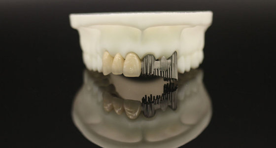 Dental Lab Prints 3D Digital Model Fabricating High - precision Dental Restoration