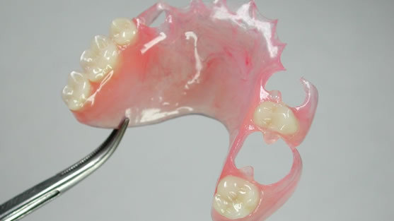 Strong And Durable Valplast Flexible Dentures / Dental Partials Denture For Loss Teeth Replacement Non Invasive