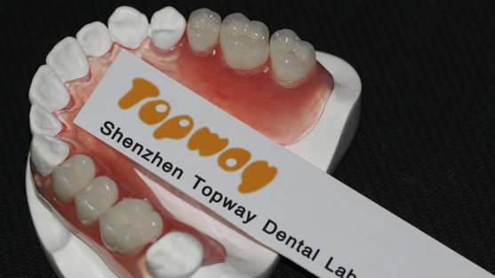 Strong And Durable Valplast Flexible Dentures / Dental Partials Denture For Loss Teeth Replacement Non Invasive