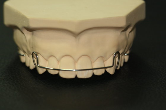 Functional Appliances In Orthodontics , Anti - Snoring Device Mouth Guard