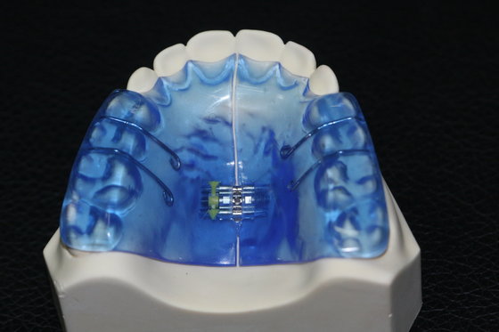 Functional Appliances In Orthodontics , Anti - Snoring Device Mouth Guard