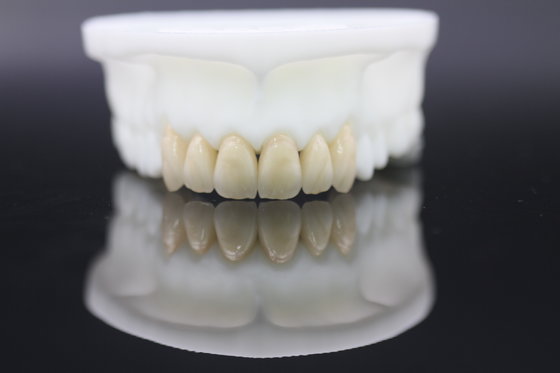 Full Contour Zirconia Dental Crown With CAD / CAM Technology Strong Strength