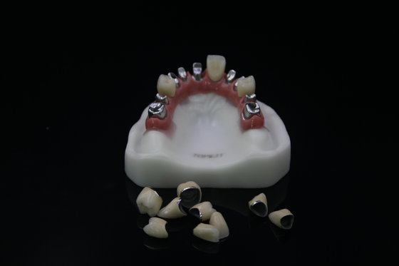 Titanium Dental Implant Abutment And Crown Individually Designed For Dental Clinic