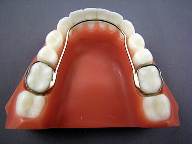 Lingual Arch Orthodontic Functional Appliances , Teeth Alignment Retainer