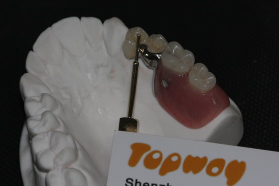 Professional MK1 Custom Dental Precision Attachments Excellent Retention Co-Cr Material