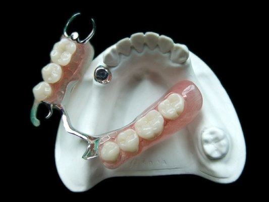 Cobalt Chromium Dental Precision Attachments , Magnetic Attachments Dentures
