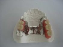 Distinguished Precision Metal Dental Framework with Titanium Material Easy Clean