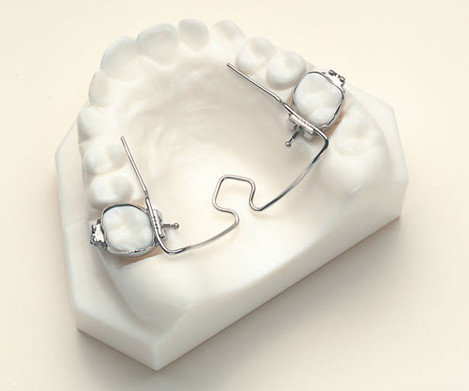 Metal Orthodontic Retainer Wire , TPA Palatal Arch Dental Teeth Appliances