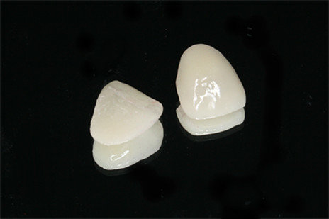 Ultra Thin Full Ceramic Dental Veneers , Porcelain Dental Caps No Need Preparation