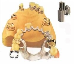 Partial Denture Tooth Attachment Telescopic Overdenture High Degree Oral Comfort