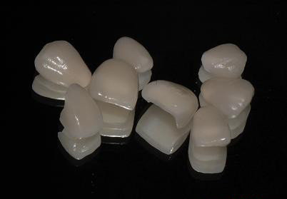 Superthin Composite Veneers Teeth 0.6MM Anterior Tooth Indication