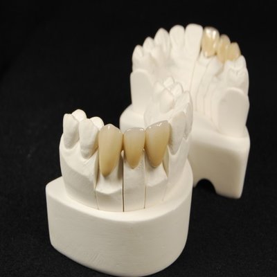 High Intensity Dental Crown Lab with Cobalt and Chromium Alloy Composite Material