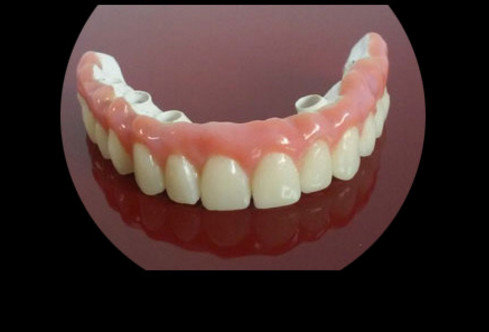 Permanent BIOHPP Dental Tooth Crown With Good Biocompatibility Health Restoration